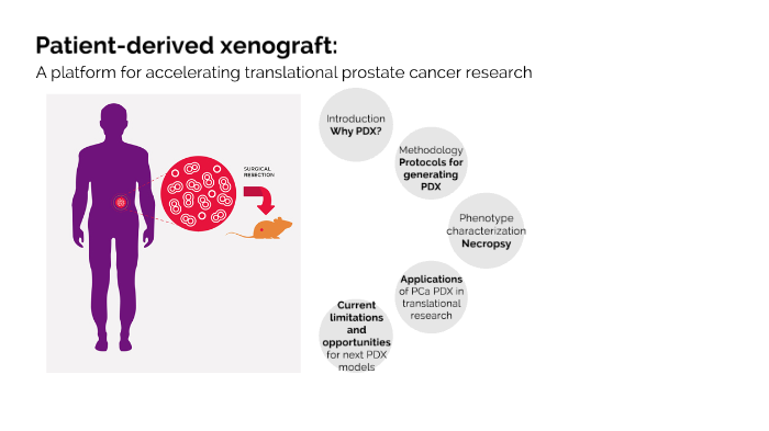 Patient derived-xenograft: a platform for accelerating translational ...