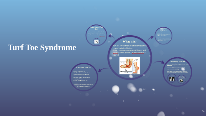 Turf Toe Syndrome by Sarah Martin on Prezi