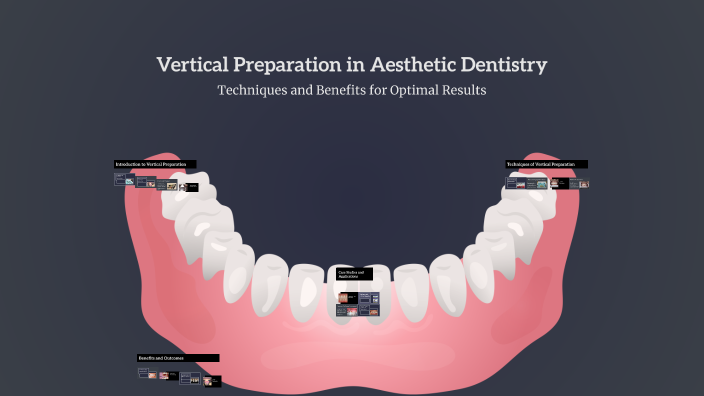 Vertical Preparation in Aesthetic Dentistry by bushra gharrah on Prezi