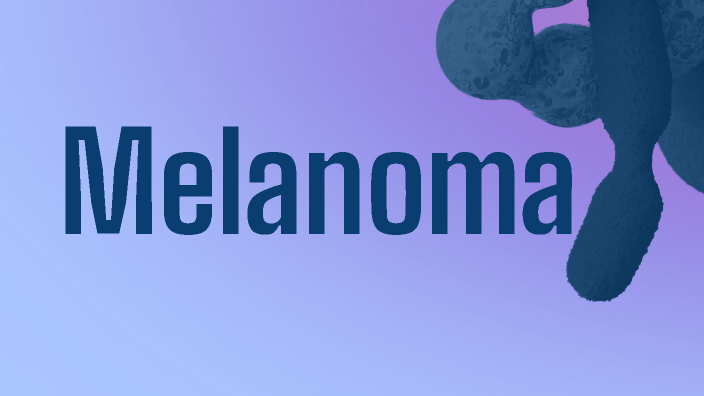 Melanoma by amanda chia on Prezi