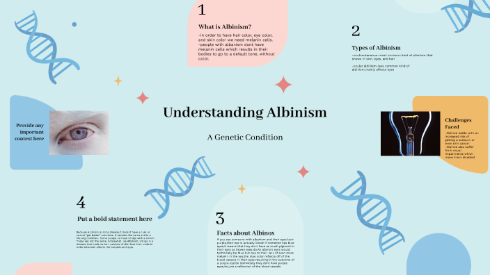 Understanding Albinism by Aryeale Gargar on Prezi