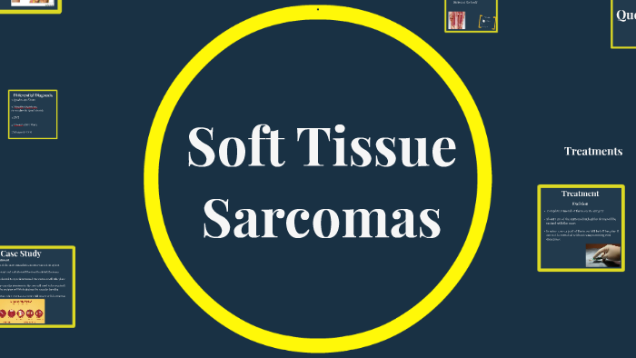Soft Tissue Sarcomas by Josh Fiss on Prezi