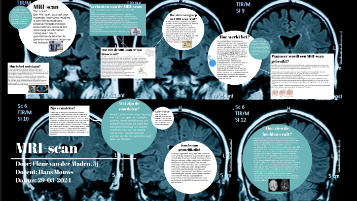 MRI-scan by Fleur van der Maden on Prezi