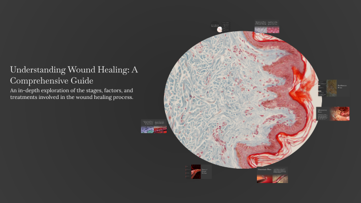 Understanding Wound Healing: A Comprehensive Guide by Sony Thomas on Prezi