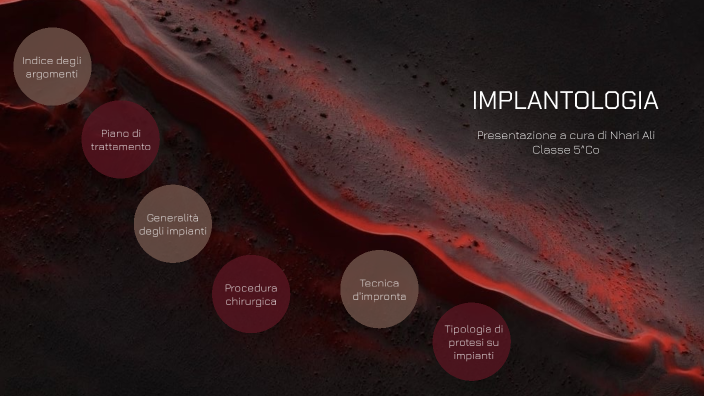 IMPLANTOLOGIA by ali nhari on Prezi