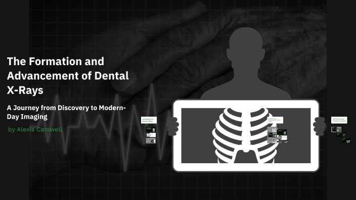 The Formation and Advancement of Dental X-Rays by Alexis Carswell on Prezi