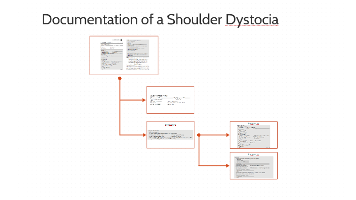 Documentation of a Shoulder Dystocia by Elizabeth Unal on Prezi
