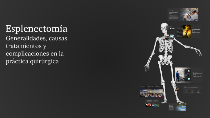 Esplenectomía by ANA CRISTINA COLINDRES PUERTO on Prezi