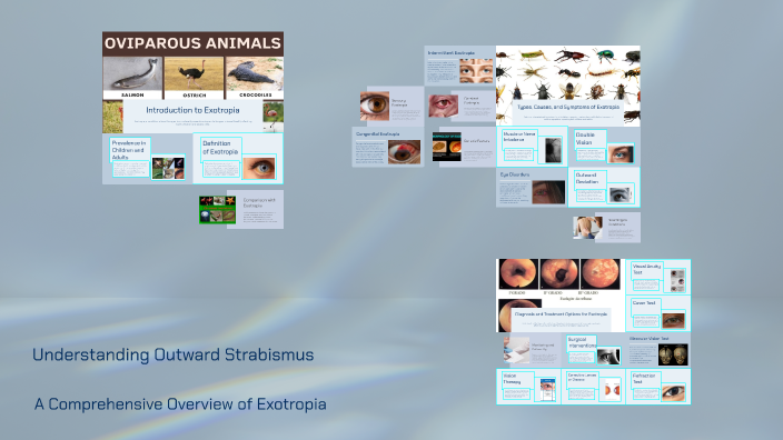 Understanding Outward Strabismus by جودي جودي on Prezi