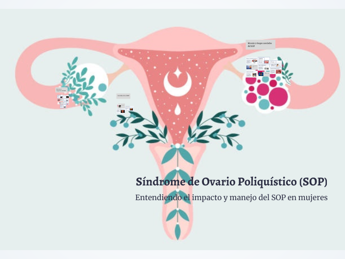 Síndrome de Ovario Poliquístico (SOP) by Lizbeth Correa on Prezi