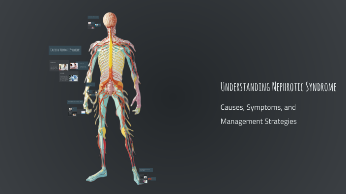 Understanding Nephrotic Syndrome by Hawraa Ali on Prezi