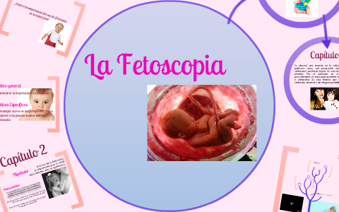 La Fetoscopia by Gabriela Grisanti on Prezi