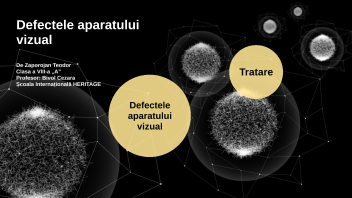 Defecte ale aparatului vizual by Teodor Zaporojan on Prezi