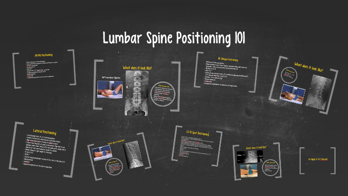 Lumbar Spine Positioning 101 by Jackie Dau on Prezi
