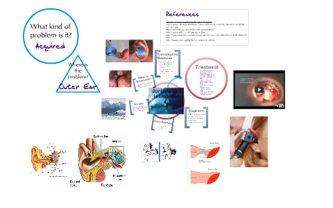 Surfer's Ear (Exostosis) by Meghan Casey on Prezi