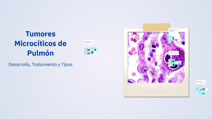 Tumores Microcíticos de Pulmón by Alexander Criollo on Prezi