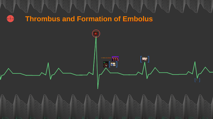 thrombus / formation of embolus by Lucinda Mondragon on Prezi