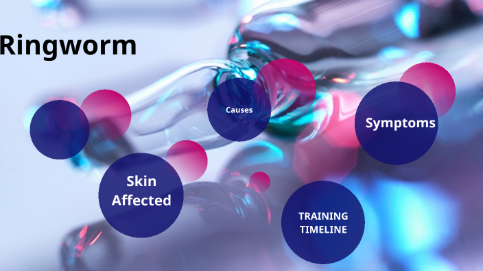 Ringworm presentation by Rosaline Garcia on Prezi