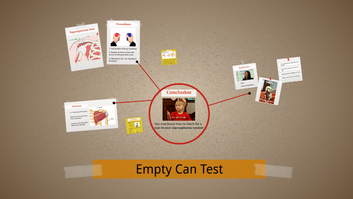 Empty Can Test by Lilly Espino on Prezi