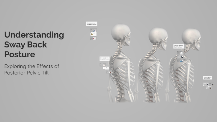 Understanding Sway Back Posture by Bahar Mahjouriab on Prezi
