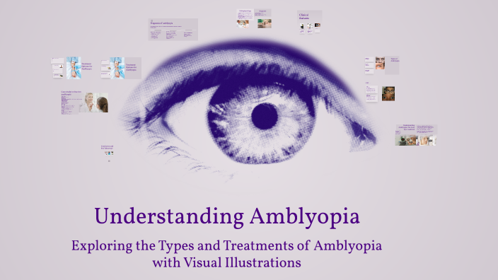 Understanding Amblyopia by Malja Sehar on Prezi