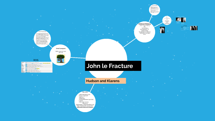 John le fracture by Hudson Rogers on Prezi