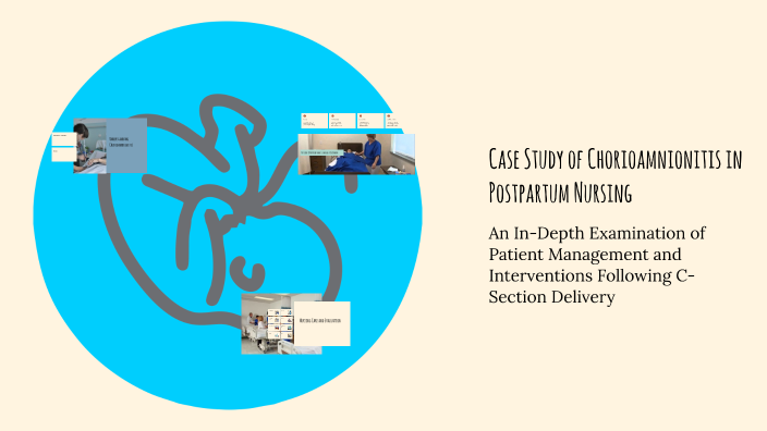 Case Study of Chorioamnionitis in Postpartum Nursing by Joni Santoro on ...