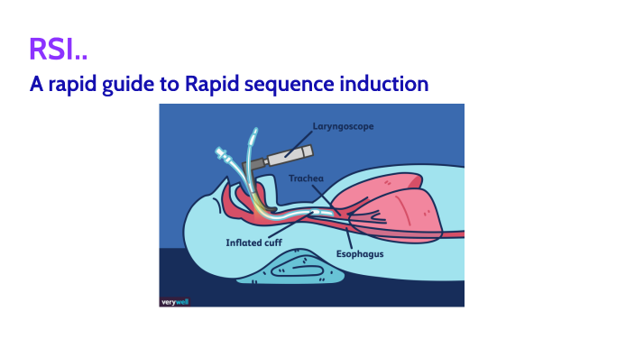 RSI .... A rapid guide to rapid sequence inductions by Becki West on Prezi