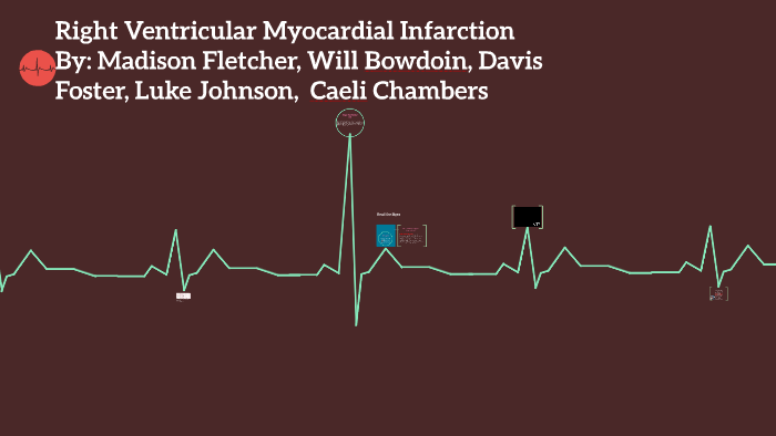 Right Ventricular Myocardial Infarction by on Prezi