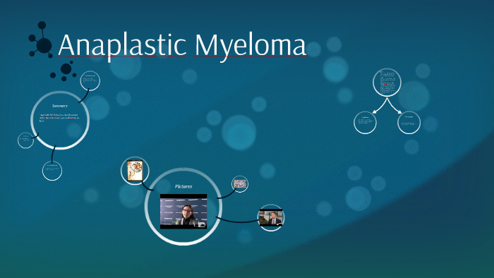 Anaplastic Myeloma by Hunter Parrett on Prezi