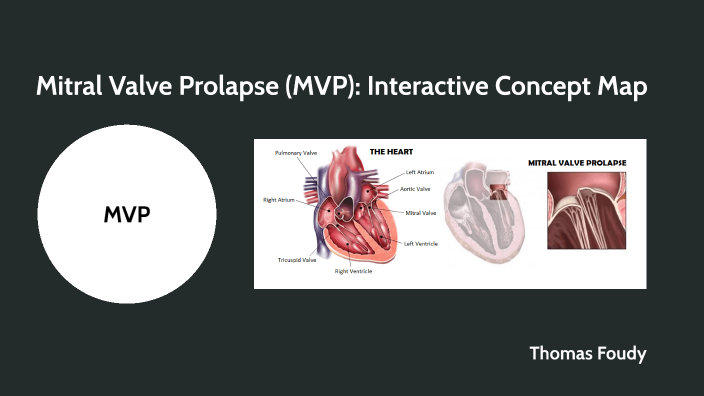 Mitral Valve Prolapse: Interactive Concept Map by Thomas Foudy on Prezi