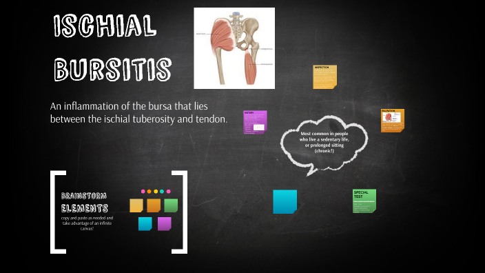 Ischial Bursitis by Lillian Garcia on Prezi