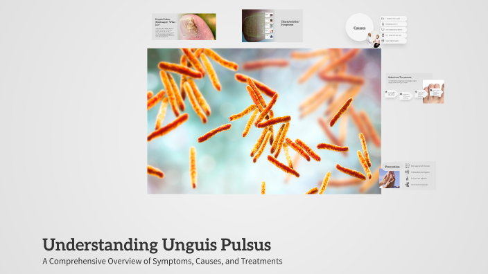Understanding Unguis Pulsus by Femke Mertens on Prezi