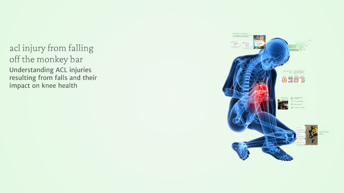 acl injury from falling off the monkey bar by Zara Tumlos on Prezi