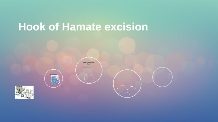 Hook of Hamate excision by abby norton on Prezi