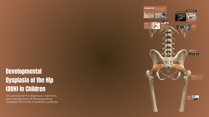 Developmental Dysplasia of the Hip (DDH) in Children by alefrado gpt on ...