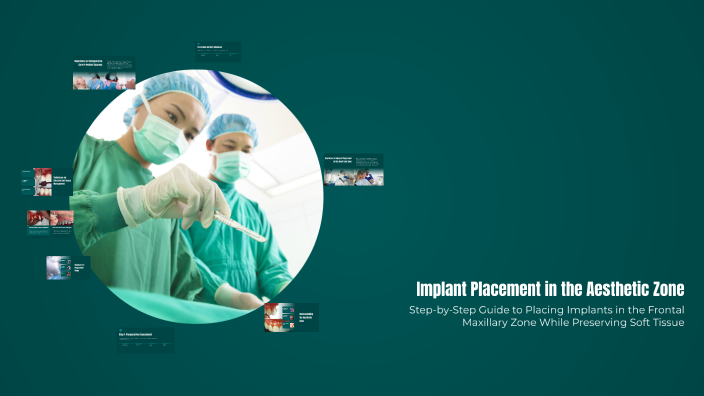 Implant Placement in the Aesthetic Zone by Jakup Vrioni on Prezi