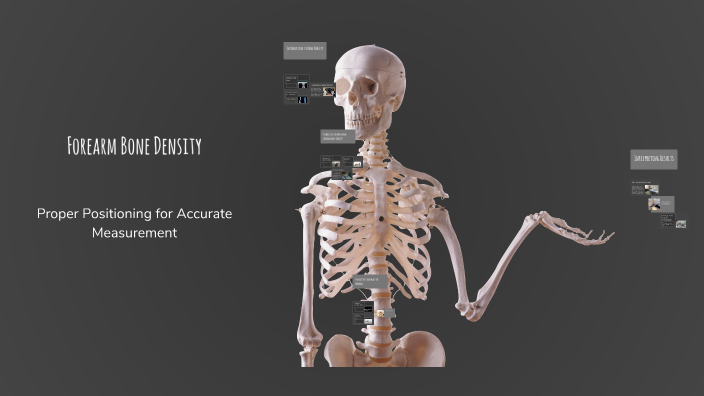 Forearm Bone Density by Gretchen Davis on Prezi