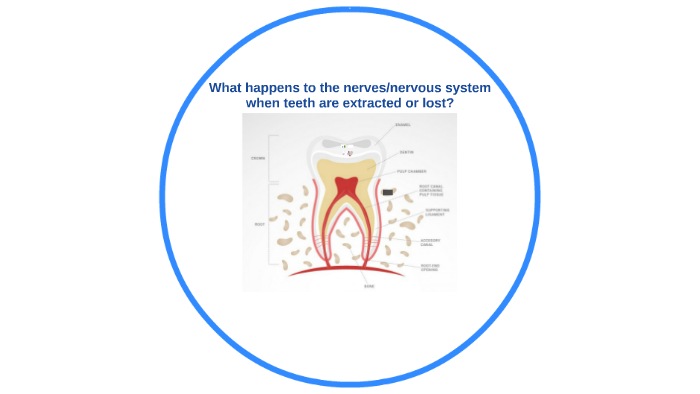 What happens to the nerves/nervous system when teeth are ext by Michael ...