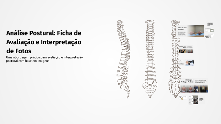 Análise Postural: Ficha de Avaliação e Interpretação de Fotos by ...