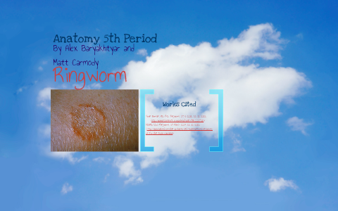 Ringworm Project by xuan popo on Prezi