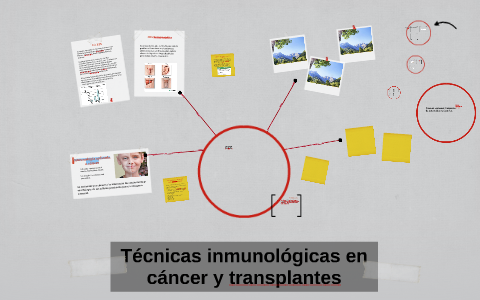 Técnicas inmunológicas en cáncer y transplantes by Cynthia Nava on Prezi
