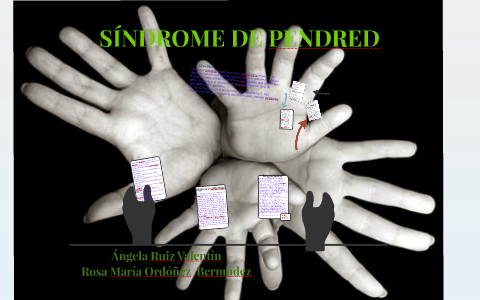 Síndrome Pendred o enfermedad Pendred. Es un trastorno genét by Rosa ...