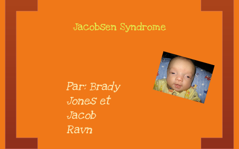 Jacobsen Syndrome by Dyson Jones on Prezi