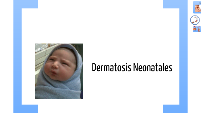 dermatosis neonatal by Adriana Loredo on Prezi