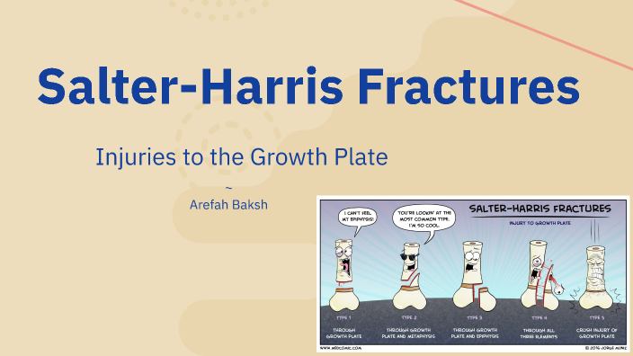 Salter-Harris Fractures by Arefah Baksh on Prezi