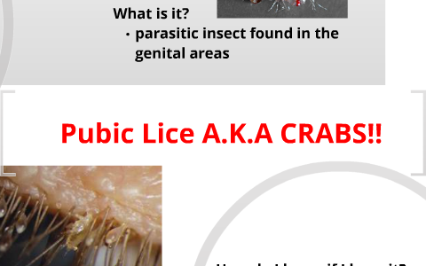 STD : Pubic Lice AKA Crabs by Juno Bierman on Prezi