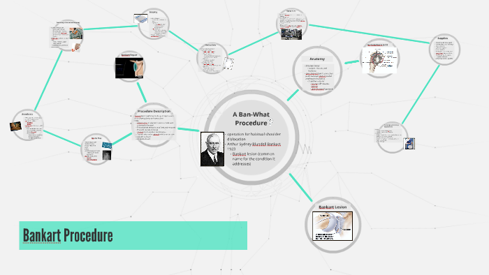 Bankart Procedure by Jordan Persaud on Prezi
