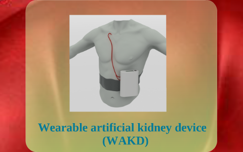 Wearable Artificial Kidney Device by Frank Simonis on Prezi