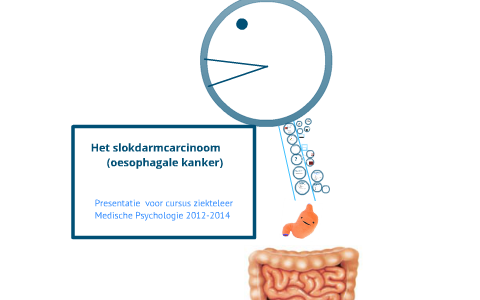 Slokdarmkanker by Roel Hogervorst on Prezi
